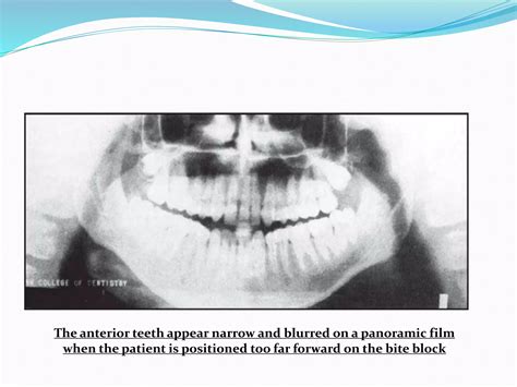 Common Errors In Opg Pptx