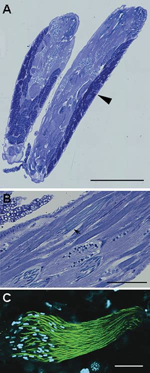 Young Adult Testes Contain Multiple Stages Of Spermatogenesis A A