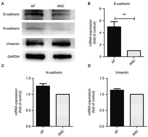 Expression Levels Of E Cadherin N Cadherin And Vimentin A