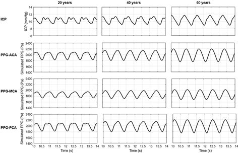 Frontiers Effect Of Intracranial Pressure On Photoplethysmographic