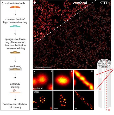 Post Embedding Labelling Of Resin Sections And Sted Nanoscopy