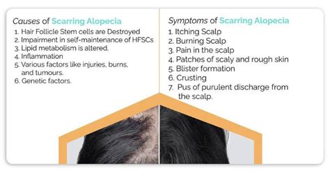 What Is Scarring Alopecia Its Causes Treatments And Symptoms