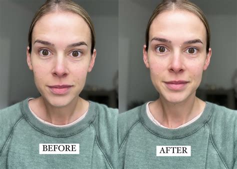 6 Benefits To Ice Rolling Your Face Gurl Gone Green