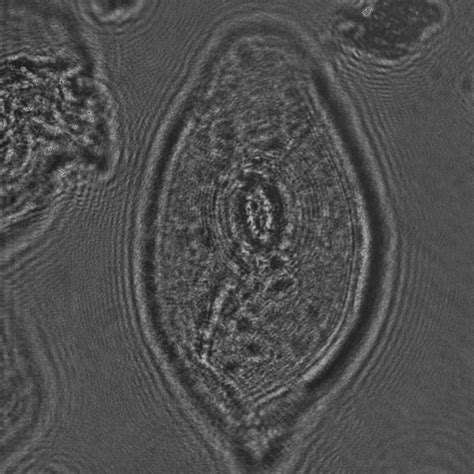 Segmentation Of High Resolution Phase Contrast Images Not Giving Any