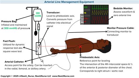 Arterial Line Setup Steps