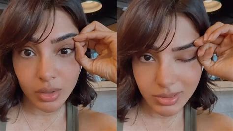 Samantha Ruth Prabhus Skin Is Ruined Due To Steroid Shots Actress