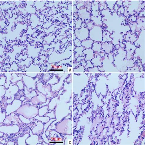 Histologic Examination Of The Lung Tissues A Control Group B Mild