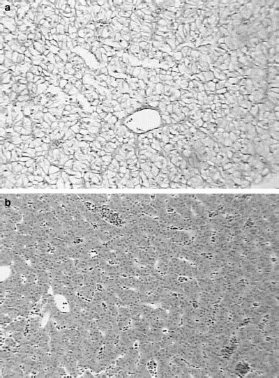 Sections Of Liver From Hatchery Reared Juvenile Winter Download