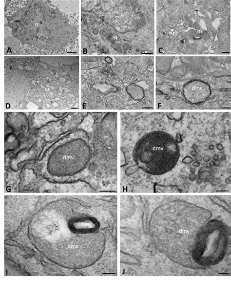 Transmission Electron Microscopy Showing The Morphology Of