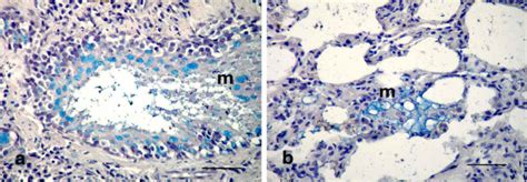 Photomicrographs Of Alcian Blue Stained Sections Of The Lung In Ltc