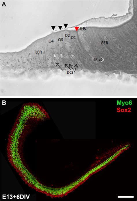 Culture Of Embryonic Mouse Cochlear Explants And Gene Transfer By Electroporation Video Jove