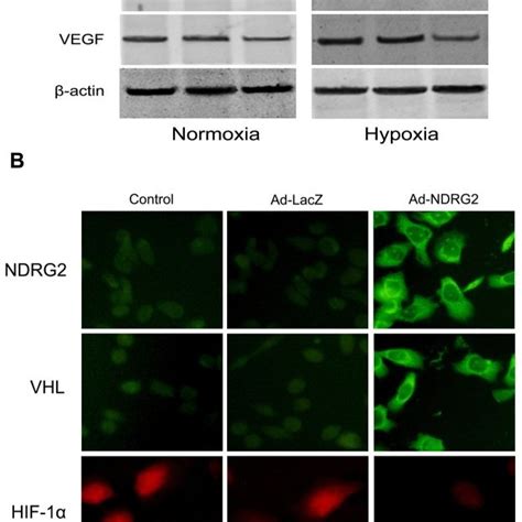 (A) 786-O, Ad-LacZ-786-O and Ad-NDRG2-786-O cells were incubated under ...
