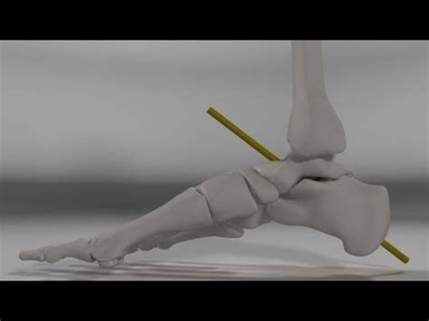 Over Pronation Supination Motion Biomechanics Of The Subtalar Joint Explained YouTube