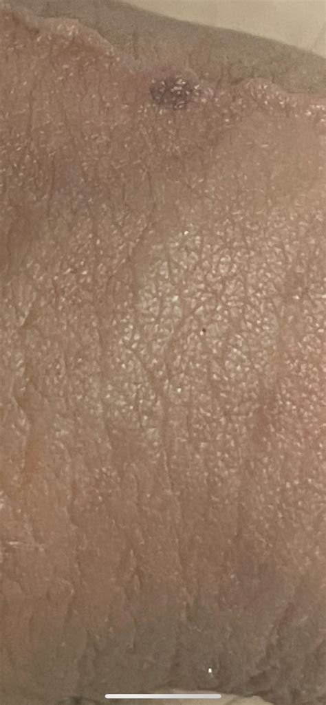생식기 점 지식in