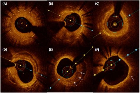 Representative Optical Coherence Tomography Various Classical Images