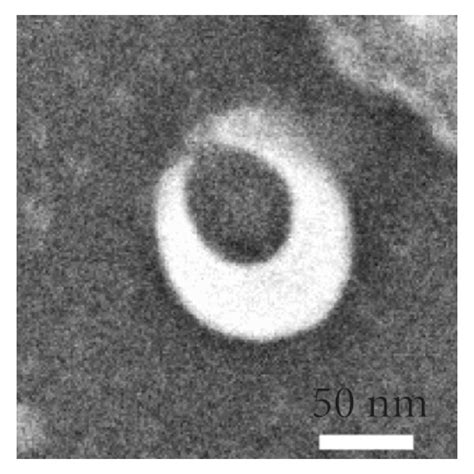 Identification Of Bone Marrow Stem Cells And Their Exosomes A