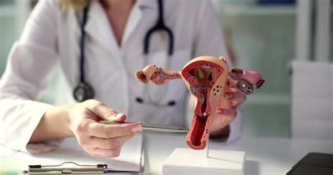 Gynecologist Doctor Points With Pen To Model Of Uterus And Ovaries Stock Video Video Of Uterus