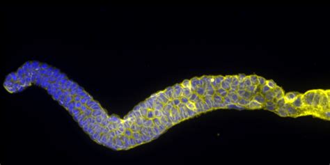 Modeling Other Genetic Diseases In C Elegans The Bai Lab