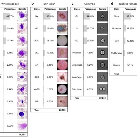 biomedical image datasets exhibit strong class imbalance little color