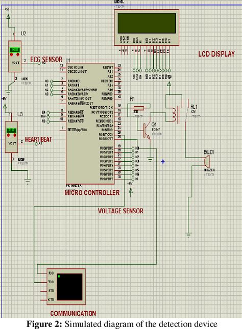 Figure 2 From Epilepsy Seizure Alert System Using Iot Semantic Scholar