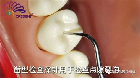 手持祛腐器 懿可仕医疗器械有限公司