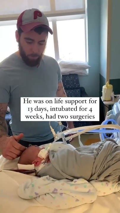 Her Son Was Born With A Birthdefect Now 3 Years Old And Thriving