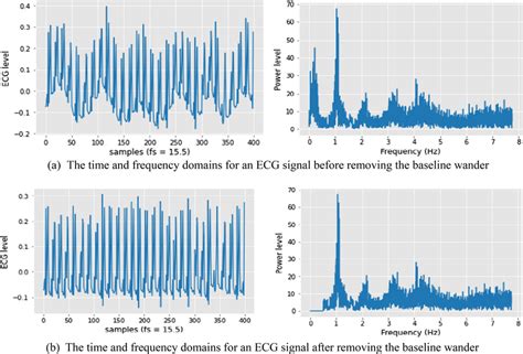 An Ecg Signal In Time And Frequency Domains Before And After Filtering