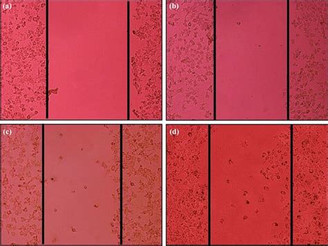 Huh 7 Cell Scratch Assay A Huh 7 Cells 24 H After Performance Of Cell