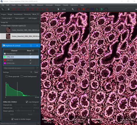 bug in brightness contrast when using multiple viewers in 0 5 1 and a