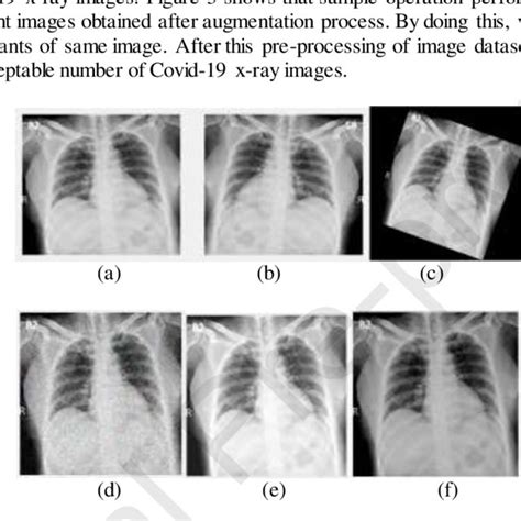Image Augmentation A Original Image B Flipped Image C Shear Download Scientific Diagram
