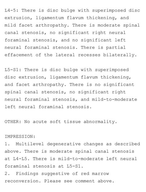 Mri Results R Sciatica