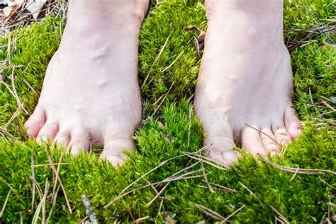 Bare Feet Of A Girl With Flat Feet Barefoot Legs Are Parallel One Is