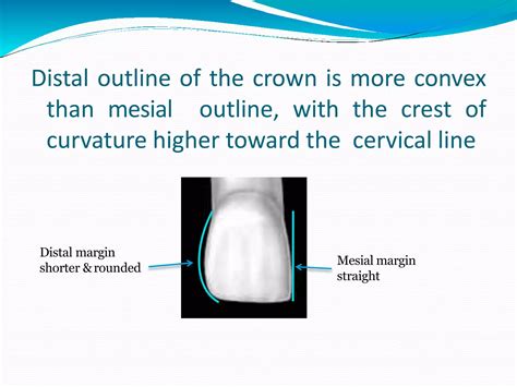 Maxillary Central Incisor Pptx