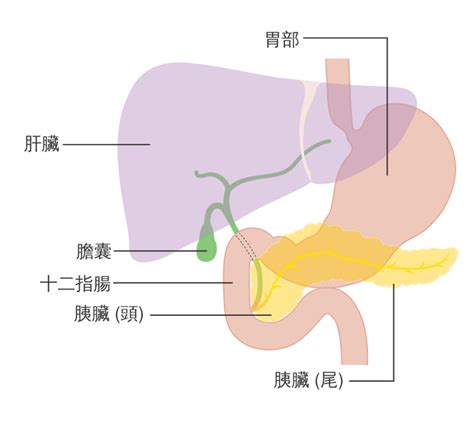 关注胰腺癌，早发现早治疗！ 知乎