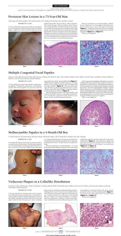 Multiple Congenital Facial Papules—quiz Case Dermatology Jama