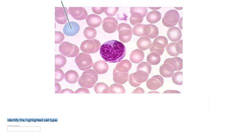 Solved Identify The Highlighted Cell Type