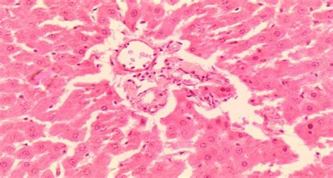 Group B Severe Hepatocellular Necrosis Portal Area Necrosis And Download Scientific Diagram