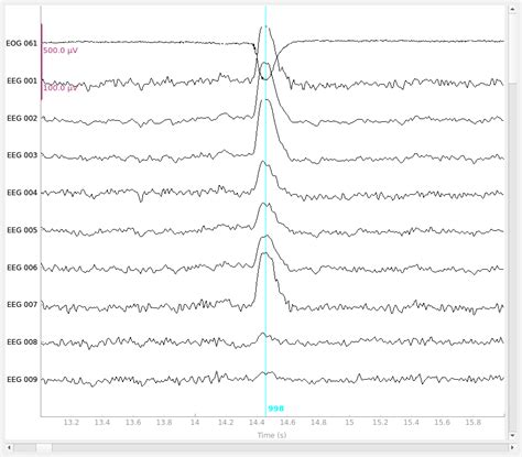 Repairing Artifacts With Regression — Mne 1110dev60g523f221bb Documentation