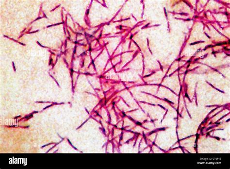 Legionella Pneumophila Stock Photo Alamy