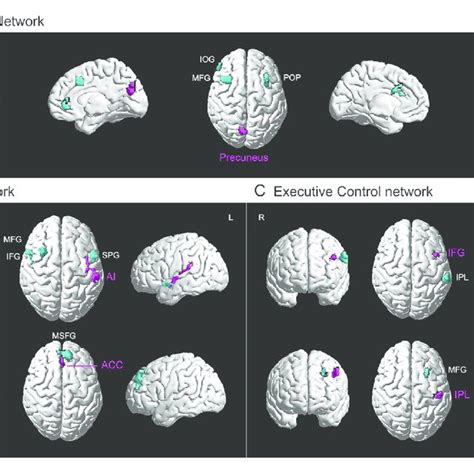 Comparison Of Resting State Functional Connectivity Between Download Scientific Diagram