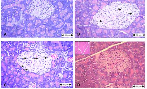 Histopathology Of The Pancreas In Female Young Rats A Pancreas Of
