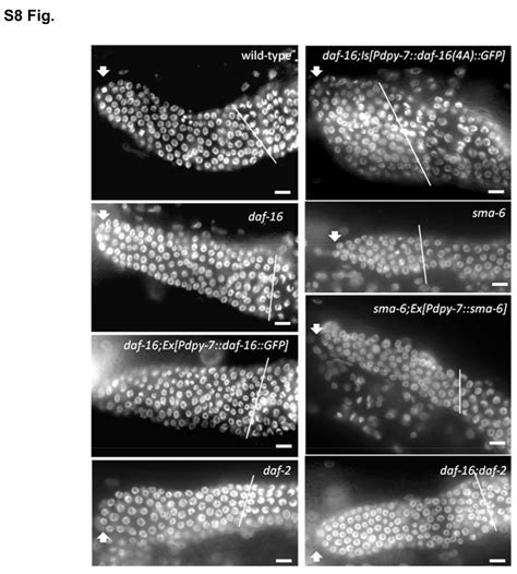 C Elegans Daf 16foxo Interacts With Tgf ßbmp Signaling To Induce