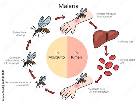 Malaria Disease Diagram Hand Drawn Schematic Vector Illustration