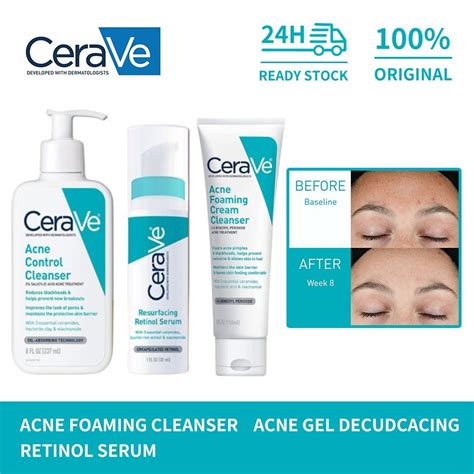 Cerave Official Store Ph Acne Foaming Cream Cleanser Acne Control