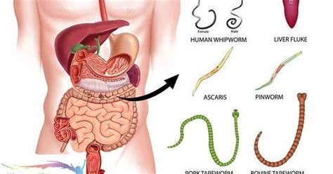 10 Symptoms You Have Parasites In Your Body And How To Remove Them
