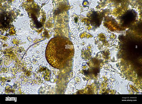 Hongos Y Microorganismos Del Suelo En Una Muestra De Suelo Y Abono En