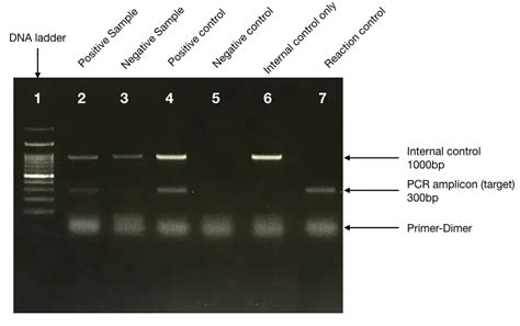 Type Of Pcr Controls Negative Positive And Internal Controls Genetic Education