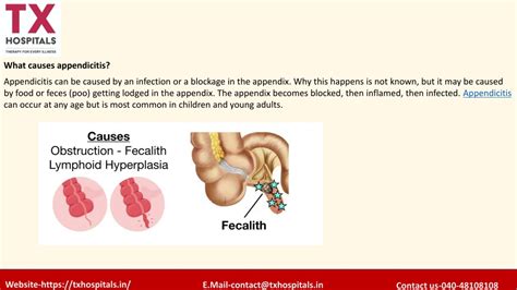 Ppt Appendicitis Symptoms Causes Diagnosis And Treatment Powerpoint