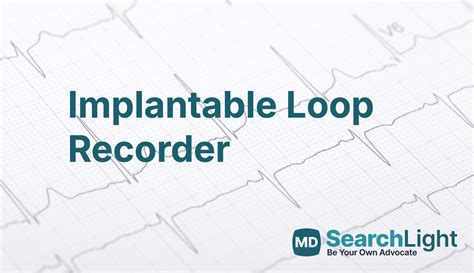 Implantable Loop Recorder Loop Recorder Md Searchlight