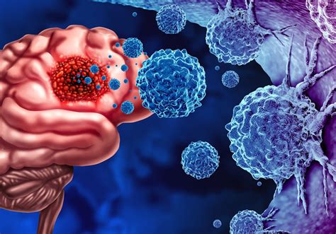 Brain Cancer Cells Vs Normal Cells